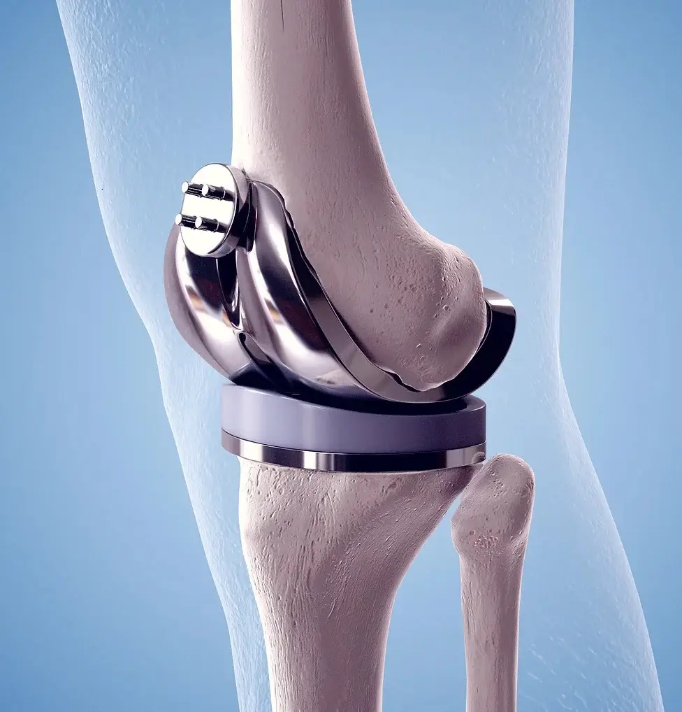 Apa Itu Genicular Nerve Block (GNB)? Untuk Sakit Lutut Kronik